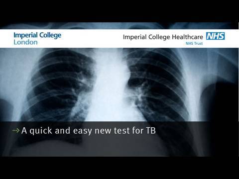 Creating a quick and easy new test for TB