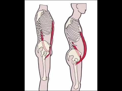 abdominal muscles weakness effect posrure#fitness#tips#medical