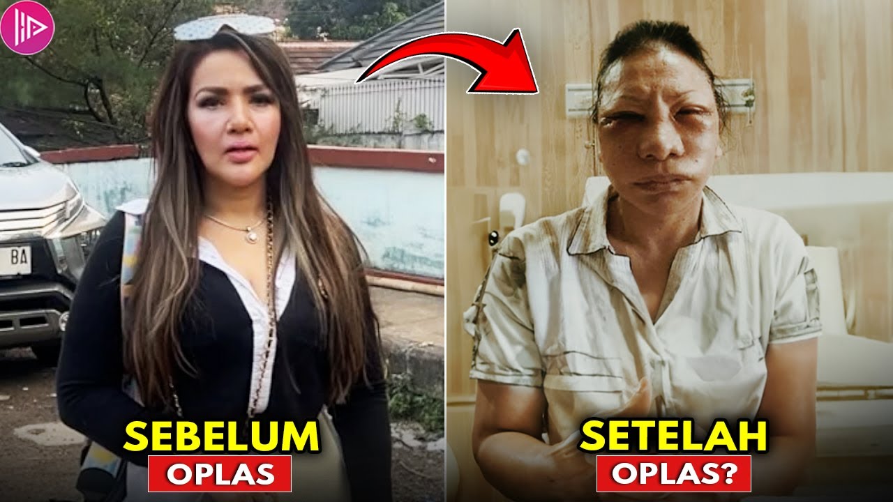 MENYESAL SEUMUR HIDUP!? Deretan Artis Tanah Air yang Dinilai Warganet Gagal Oplas