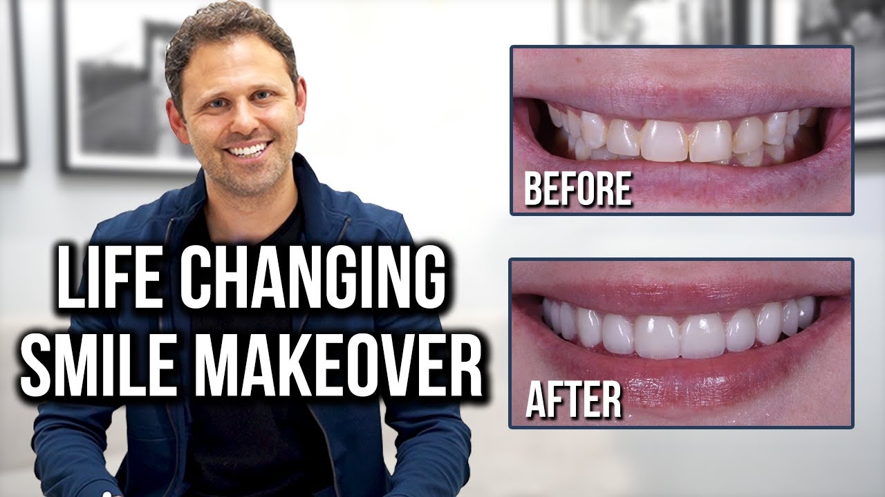 Life Changing Smile Makeover - Dental Science