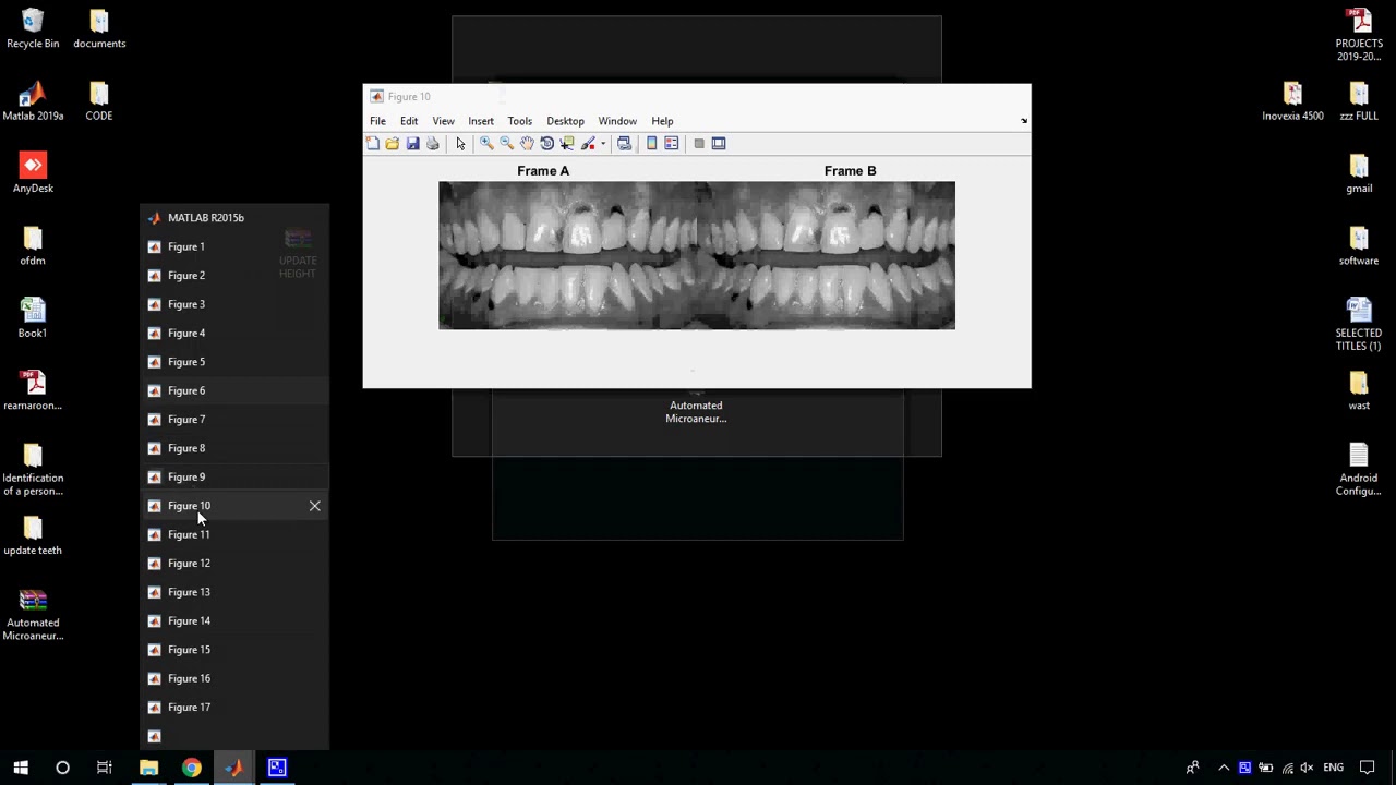 Tooth Gap Detection In Matlab Okok Projects Final Year Projects Bangalore Chennai Hyderbad
