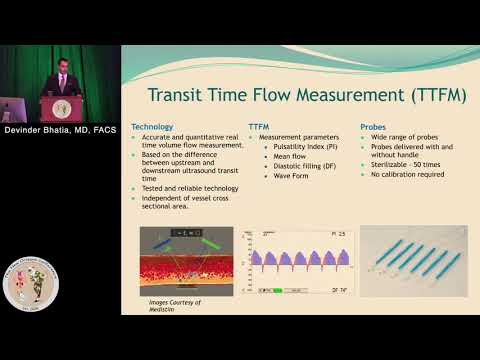 OP CAB - What Is The Current State? (Devinder Bhatia, MD, FACS)