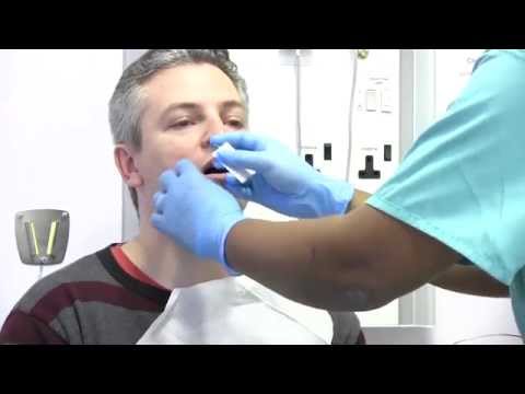 Barrett's Oesophagus Screening Research | Oesophageal Cancer | Cancer Research UK
