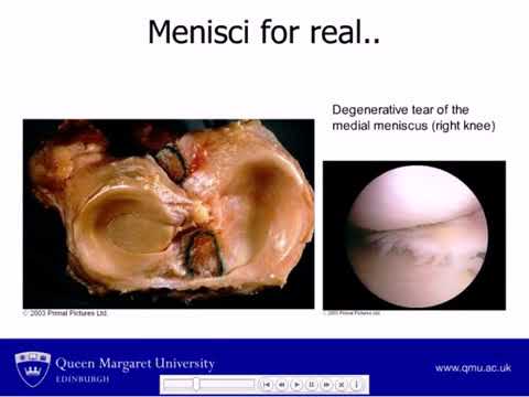 The knee region - An overview