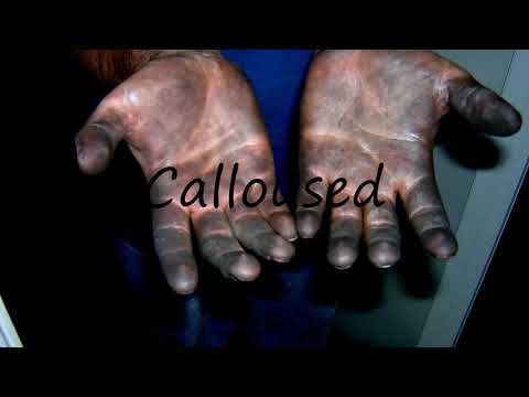 How to pronounce Calloused?
