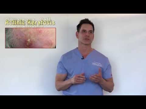 Pre-Cancers or Actinic Keratosis Treatment Options With Dr. Timothy Jochen