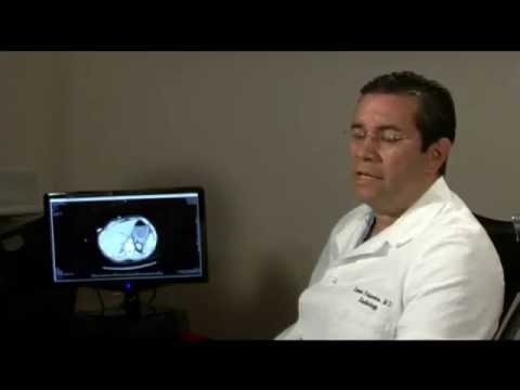 What is a CT Scan?