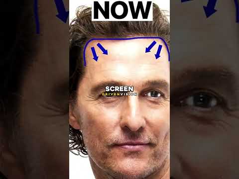 Did Matthew McConaughey Really Get a Hair Transplant? The Truth 😱