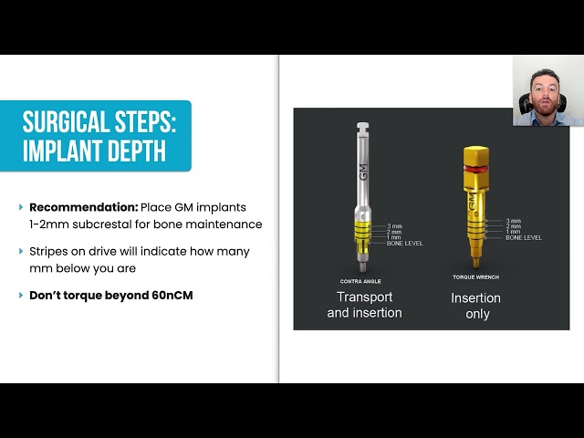 Surgical Steps for All on X