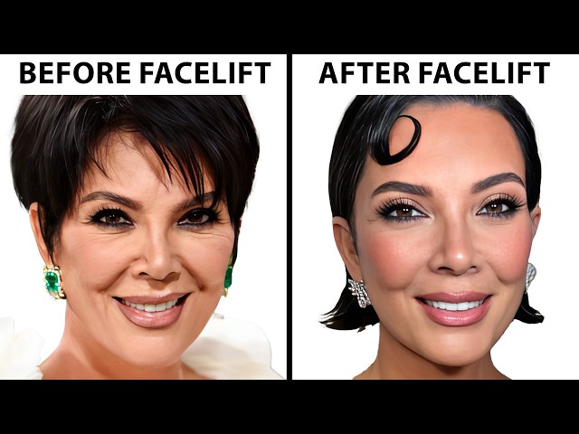 The Secrets Behind Celebrities Aging Backwards: Modern Facelift ...