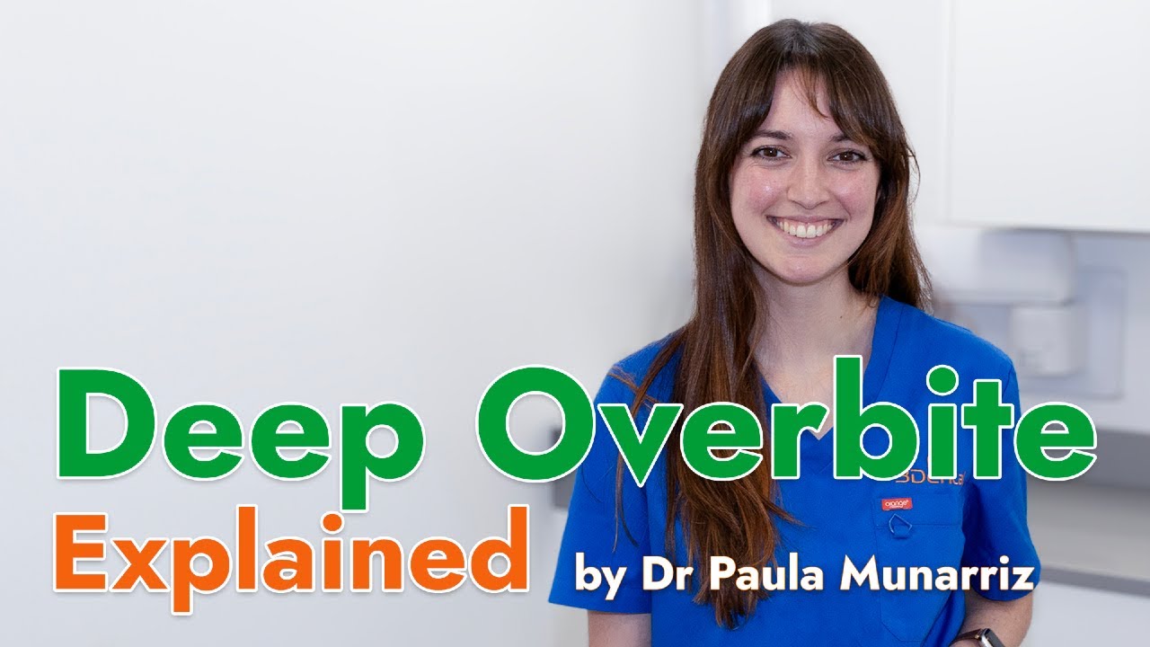 What Is a Deep Overbite? | Causes, Problems & Treatment Options Explained by Dr. Paula