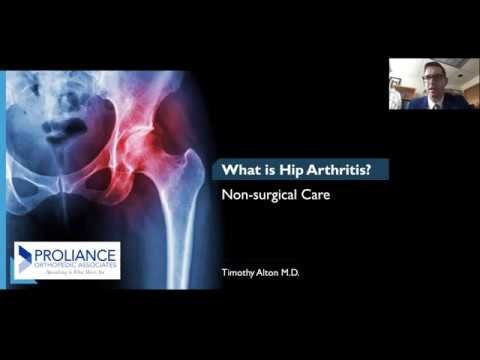 Dr Alton Lecture Series: Hip Conditions | What is Hip Arthritis and Non-Surgical Care?