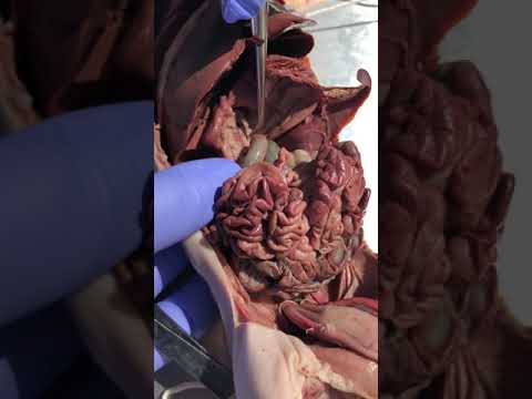 Fetal Pig Dissections 15: Liver, Pancreas, & Duodenum