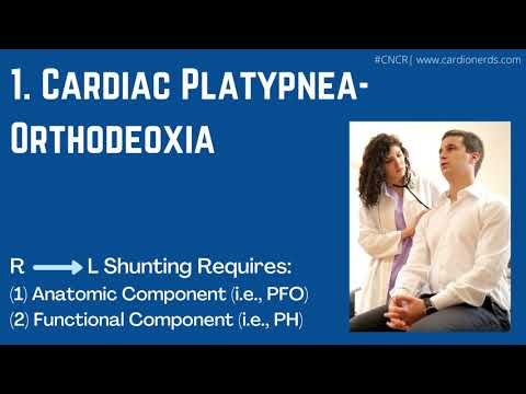 49. Case Report: Platypnea-Orthodeoxia secondary to a PFO - Allegheny Health Network