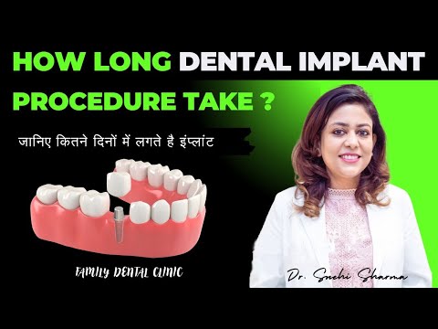 How long does a Dental Implant procedure take? | Dr. Snehi Sharma