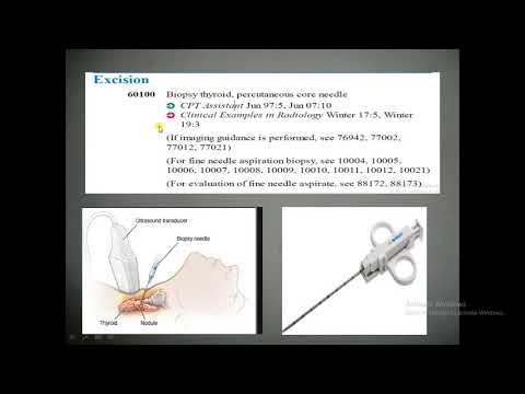 |Medical Coding Online Training| 60100,60200 Biopsy of Thyroid and Excision of cyst of Thyroid