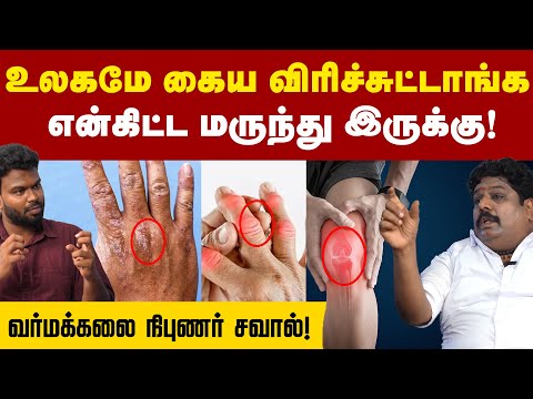 Arthritis: முடக்குவாதம் வர்மக்கலை மூலம் சரி பண்றேன் | Positivitea | Varmakalai