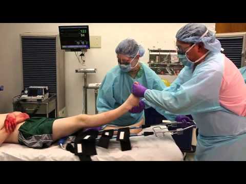 Traction Splint ATLS