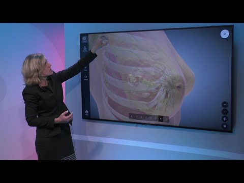 Metastasis of Breast Cancer