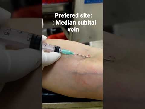 Phlebotomy