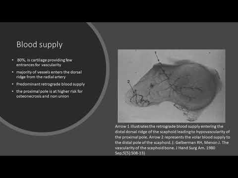 Scaphoid Fracture a review