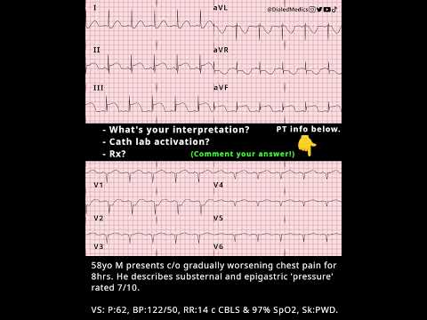 12 Lead EKG Practice interpretation