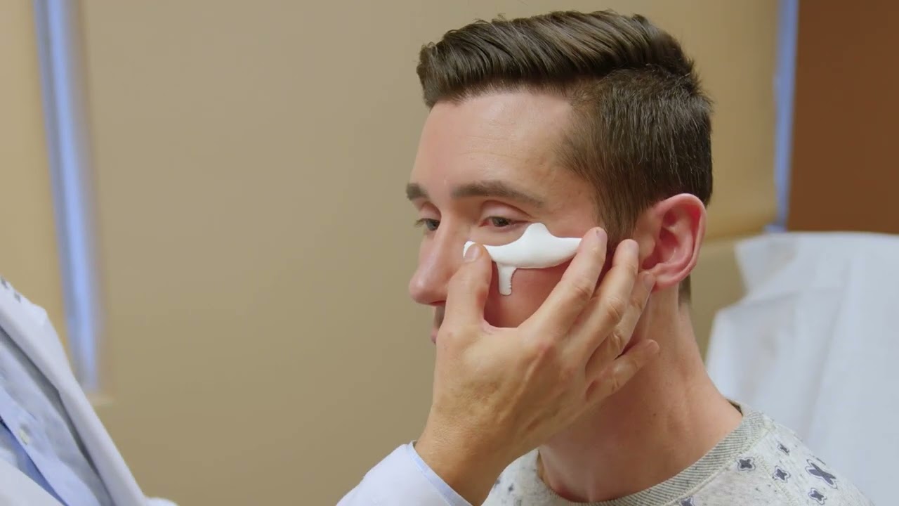 Designing Custom Facial Implants - What Every Patient Should Know