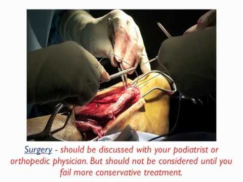 Achilles Tendonitis