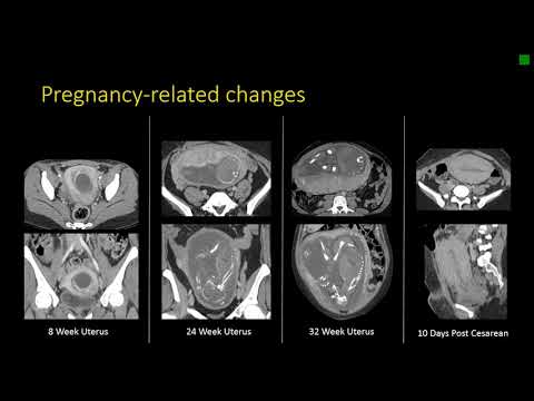 Gynecologic Radiology Anatomy