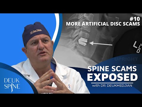 More Artificial Disc Scams on Facebook | (Ep:10 Spine Scams Exposed)