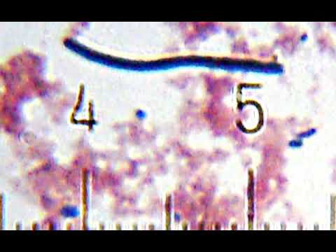 Lactobacillus delbrueckii subsp. bulgaricus | Wikipedia audio article