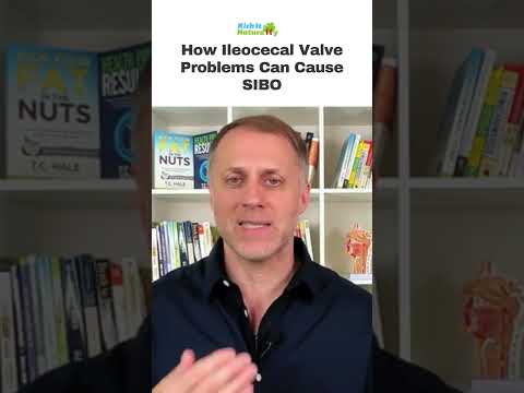 How Ileocecal Valve Problems Can Cause SIBO