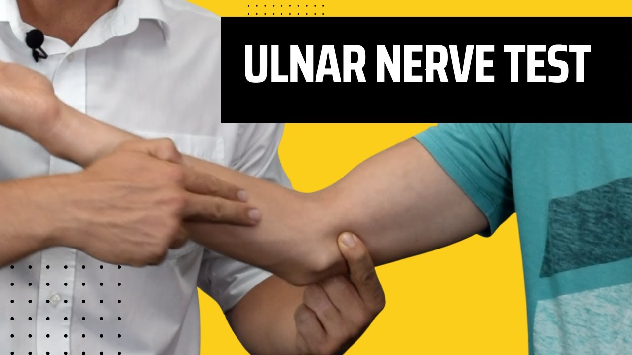 How to Test for Ulnar Nerve Entrapment (Cubital Tunnel Syndrome at the Elbow