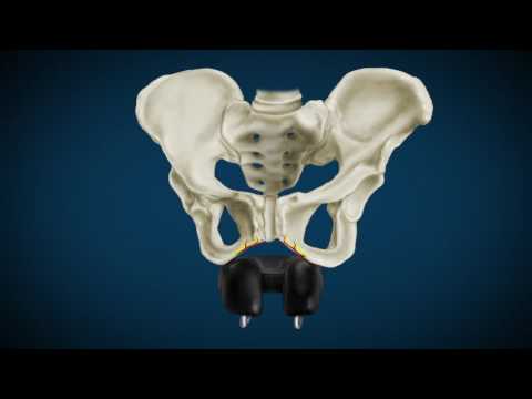 ISM - Fit, Technology, and Health