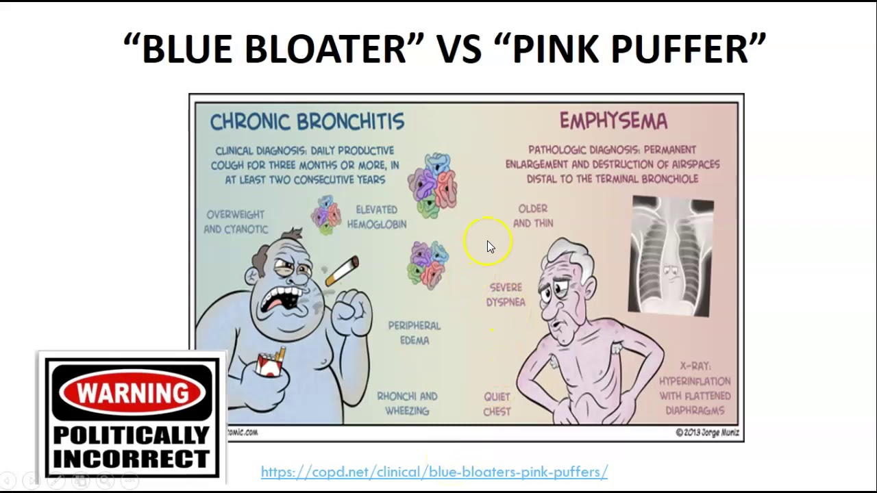 COPD Overview Fall 2019