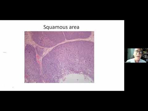 Genitourinary Pathology community of interest meeting: June 2023