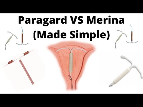 Birth Control Implants (Paragard VS Mirena)