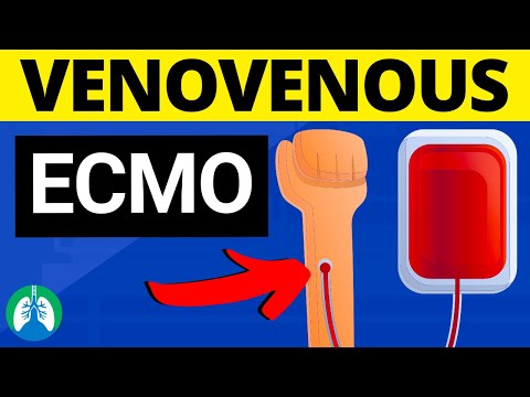 Venovenous Extracorporeal Membrane Oxygenation (Medical Definition)