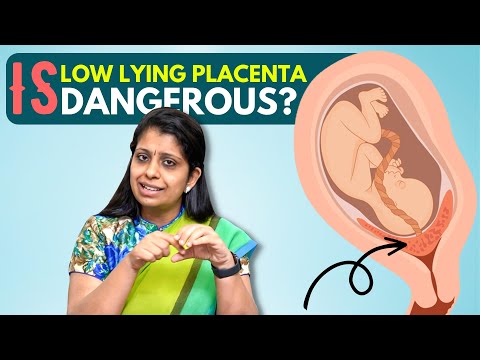Is Low Lying Placenta Dangerous | கர்ப்ப காலத்தில் நஞ்சுக்கொடி கீழிறங்கினால் ஆபத்தா ?
