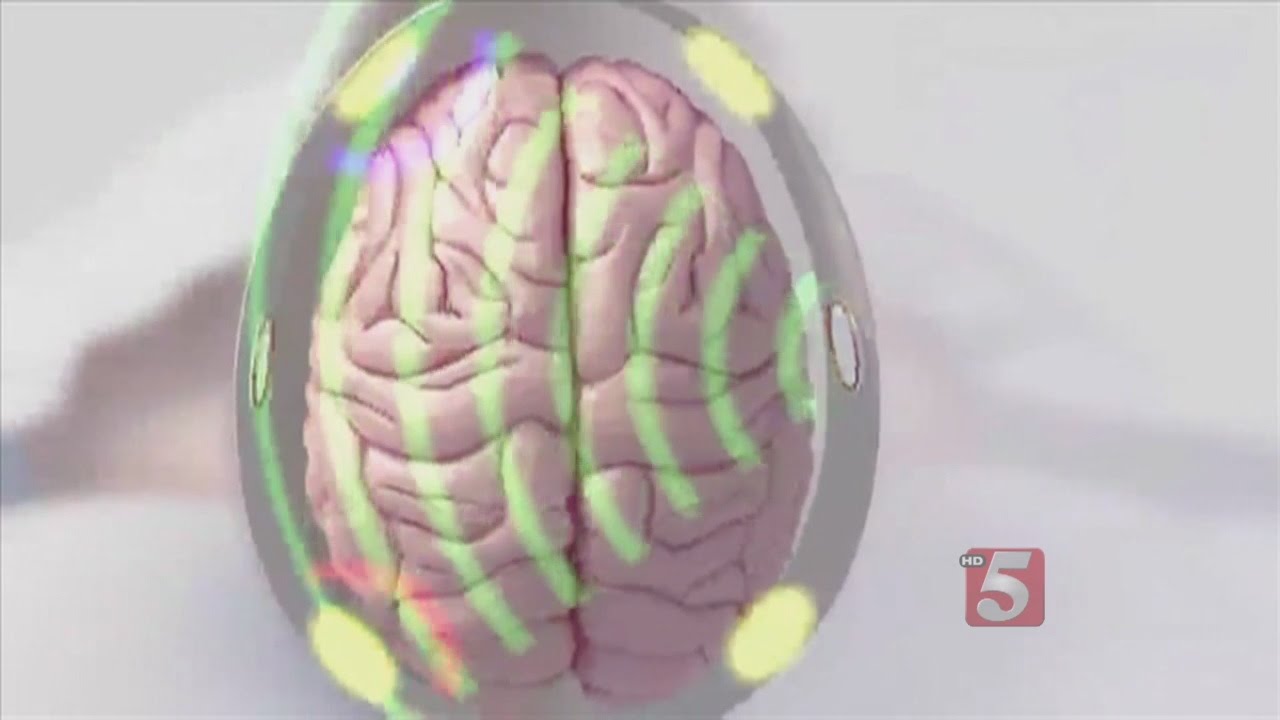 Scientists Study Effects Of 'Space' On Brain