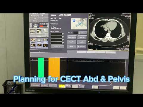 CT Scan of Abdomen Pelvis with contrast | full planning and procedure |@discoveryzsm7667