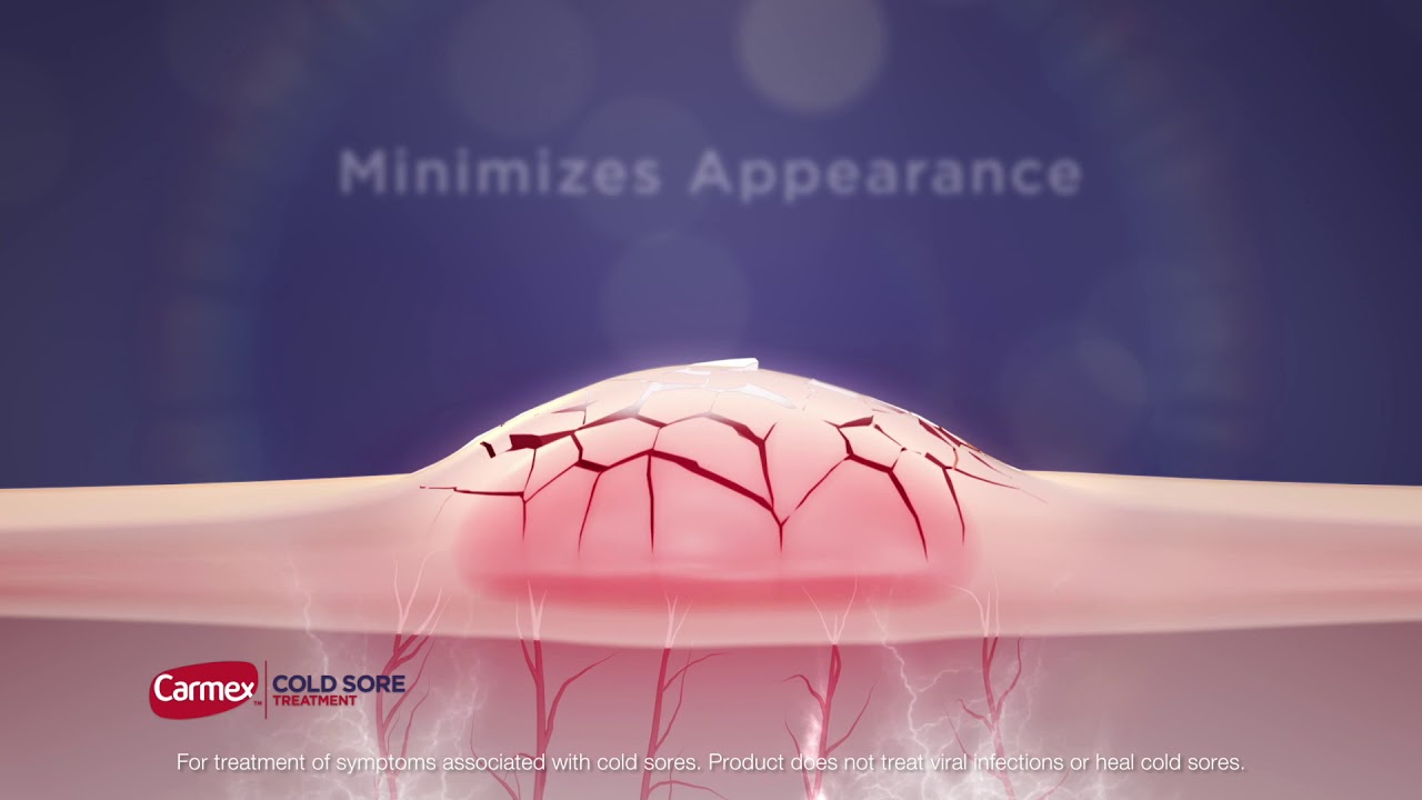 Watch how Carmex Cold Sore Treatment Works