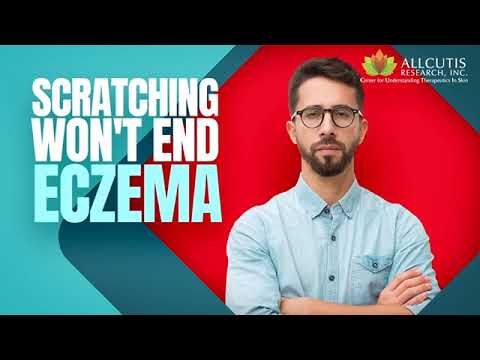 Moderate to Severe Eczema (Atopic Dermatitis) Study