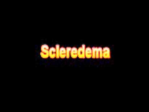 What Is The Definition Of Scleredema Medical School Terminology Dictionary