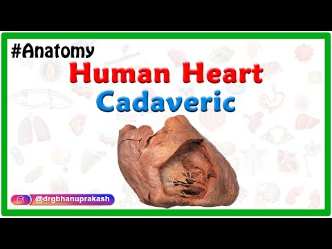 Human Heart Cadaveric Anatomy (Clinical Application) Apex, Base, Pulmonary sinuses, Coronary sulcus