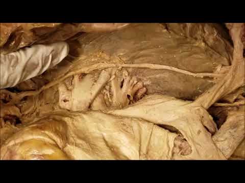 PULMONARY HILUM THORACIC DUCT PLEURAL SPACE and Clinical Correlations – Sanjoy Sanyal