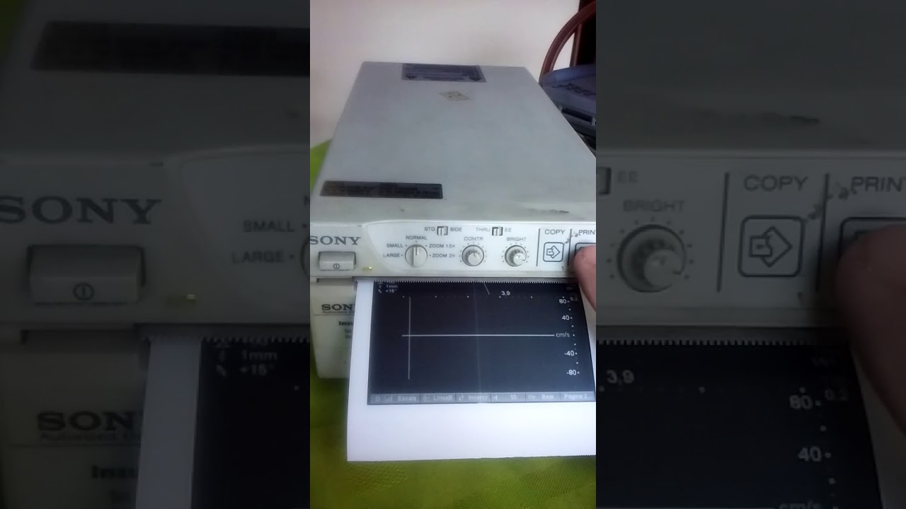 Printer ecógrafo marca Sony