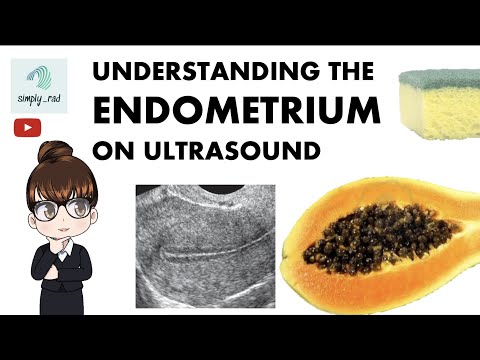 Understanding the Endometrium on Ultrasound