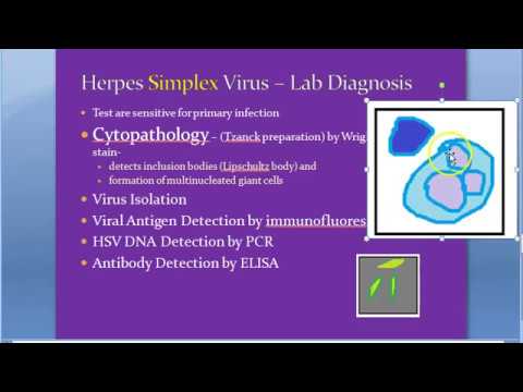 Cowdry Type B Inclusion Bodies