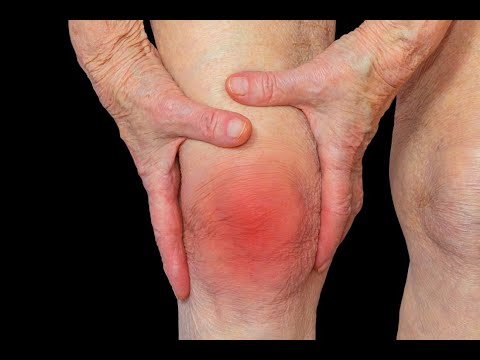 Arthrotomy CPT codes - simplify medical coding